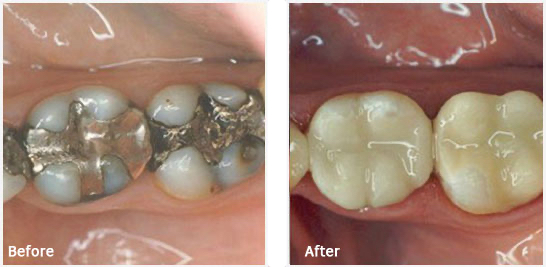 Health And Dental Education Archives Smile Sarasota